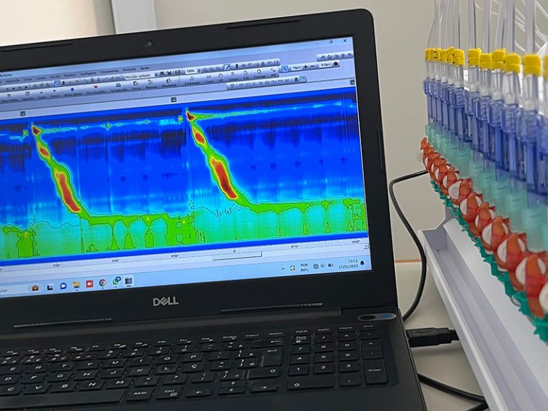 PHmetria Esofágica 24Horas - Clínica Concon